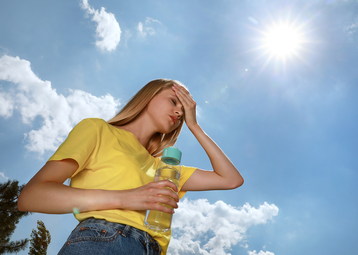 Insolation : symptômes et traitements