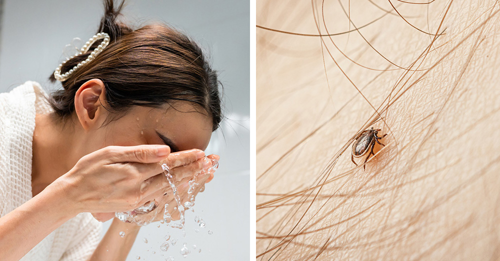 Des milliers d'acariens résident sur votre peau