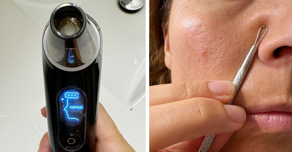 J’ai testé deux solutions pour retirer les points noirs: mon verdict