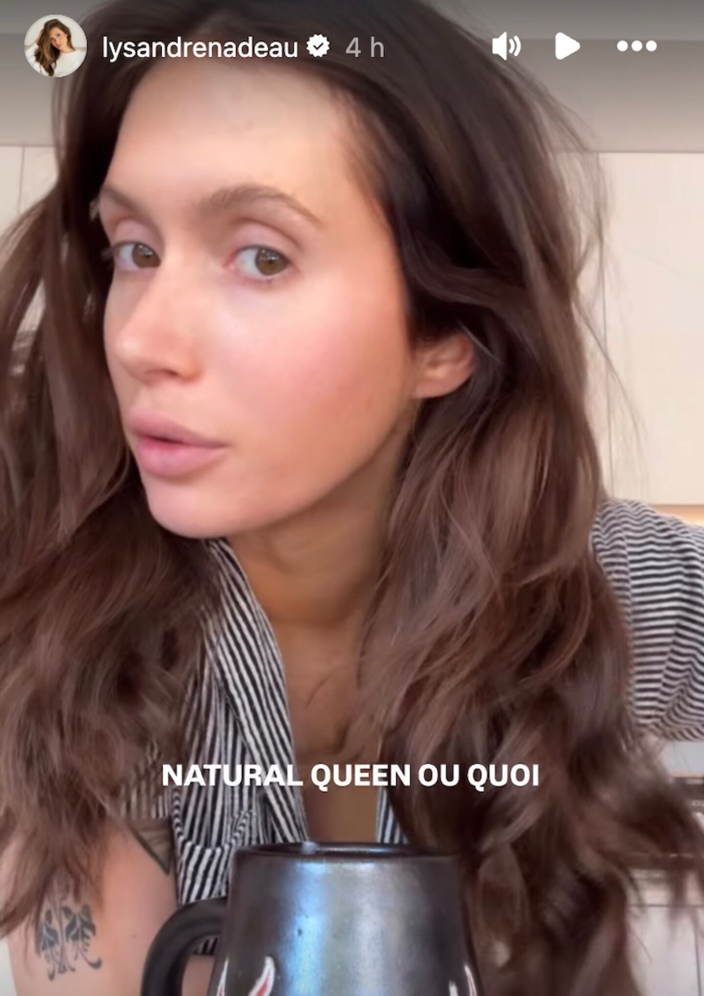 Retour au naturel: Lysandre Nadeau a fait fondre ses injections au visage